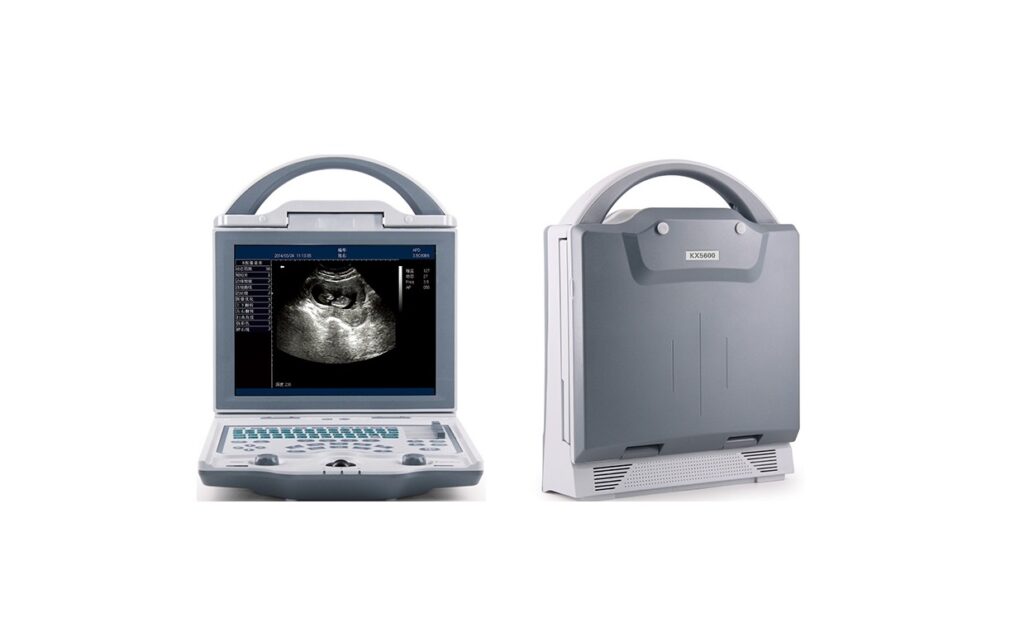 Rechargeable Human Ultrasound Scanner -KX5600 - MEDICAL AND DENTAL ...
